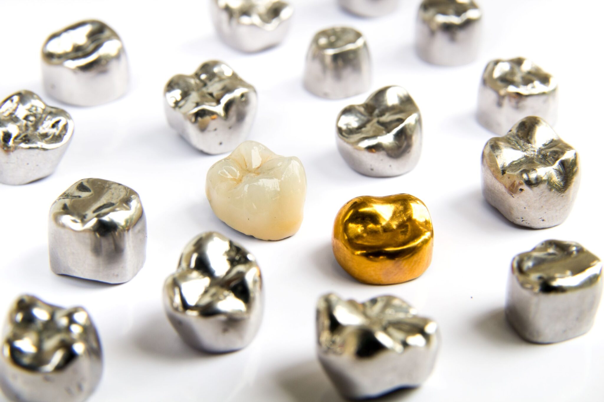 Royal Reckoning: What’s the Best Material for Dental Crowns? | Little ...
